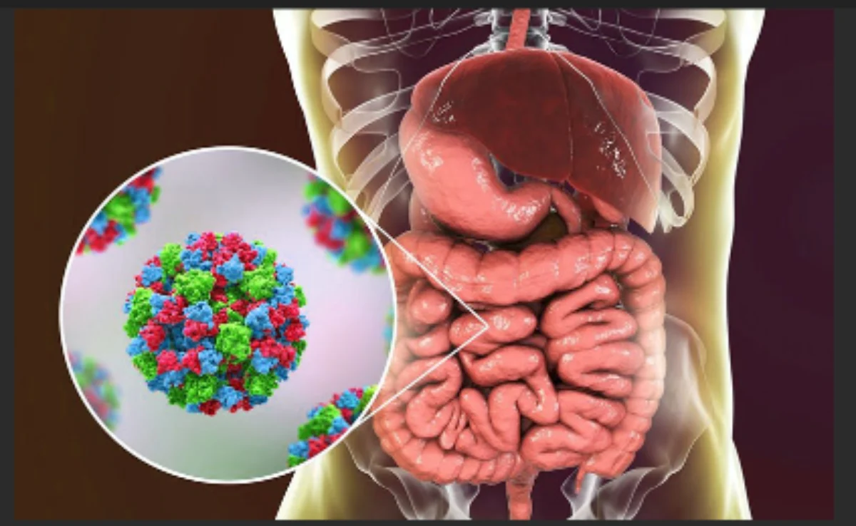 Kenali Yuk Penyebab Infeksi Saluran Pencernaan Dan Cara Pengobatan Nya ...